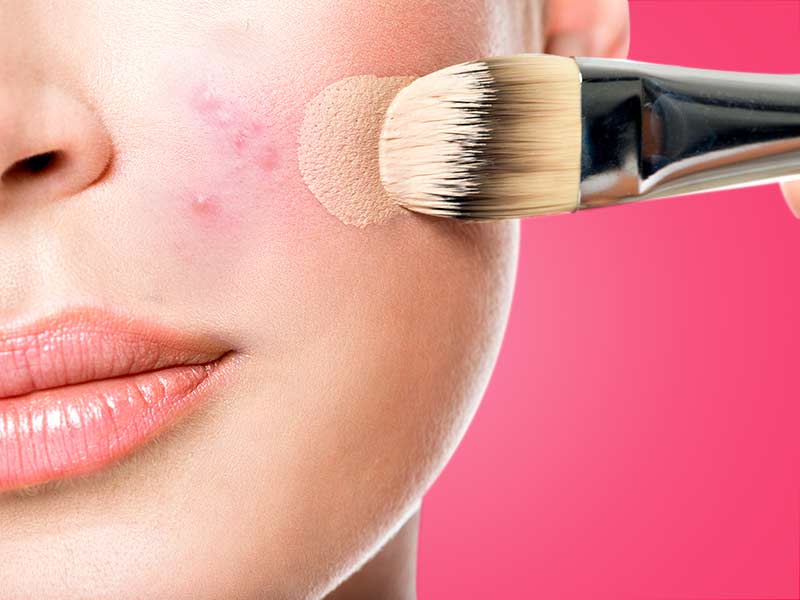 How To Hide Pimples With The Help Of Makeup Lifealth how-to-hide-pimples-with-the-help-of-makeup-lifealth